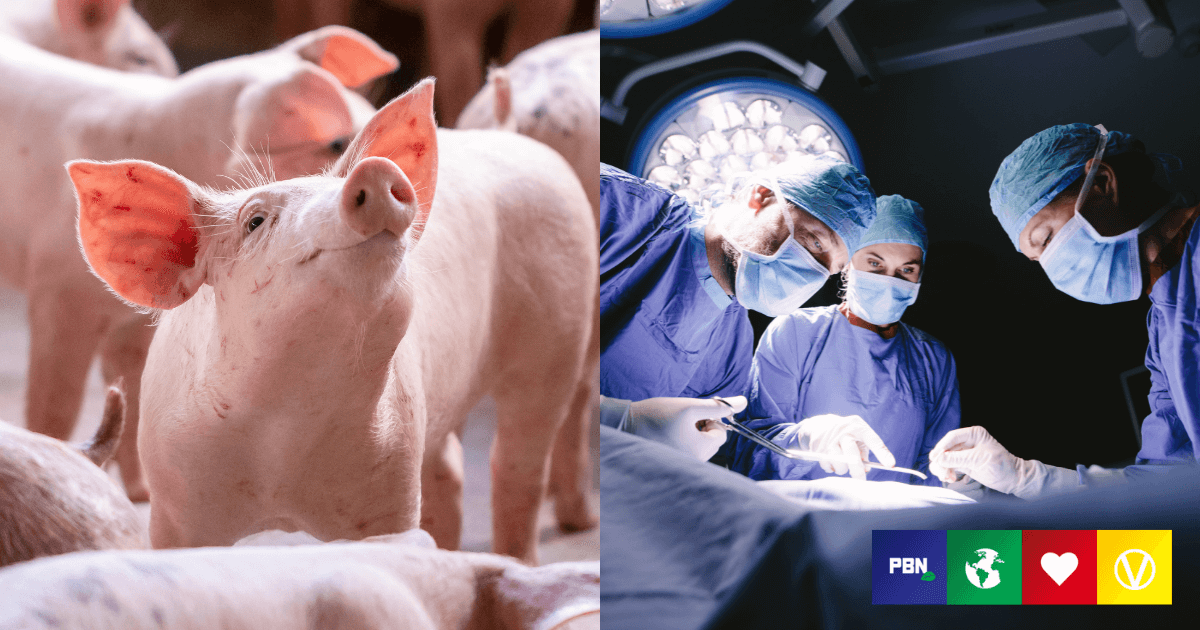 Surgeons Transplant Pig Kidney Into A Human For The First Time, But Is ...